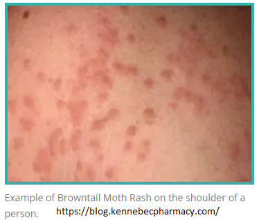 All Things Browntail-Moth Awareness - Gardiner Public Library